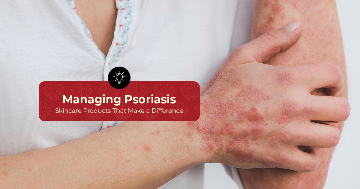 Managing Psoriasis: Skincare Products For Psoriasis